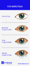 When to See a Doctor for an Eye Infection - Doctor On Demand