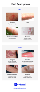 When to go to Urgent Care for Rash: When is a Rash Serious?