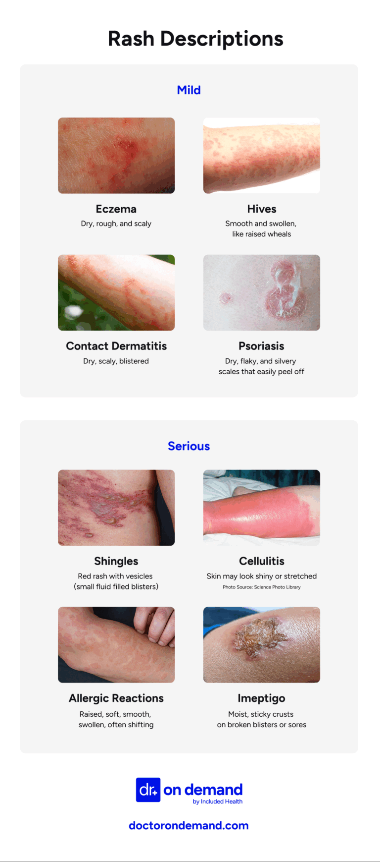 When to go to Urgent Care for Rash: When is a Rash Serious?